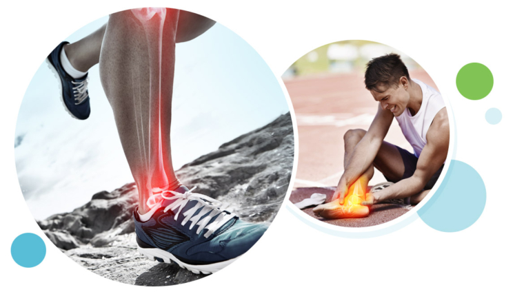 Ankle Instability and Rehab Treatment | Northstate Foot and Ankle